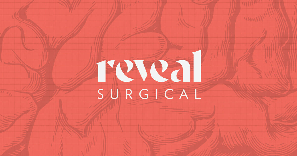 Tissue Characterization Systems For Tumor Assessment | Reveal